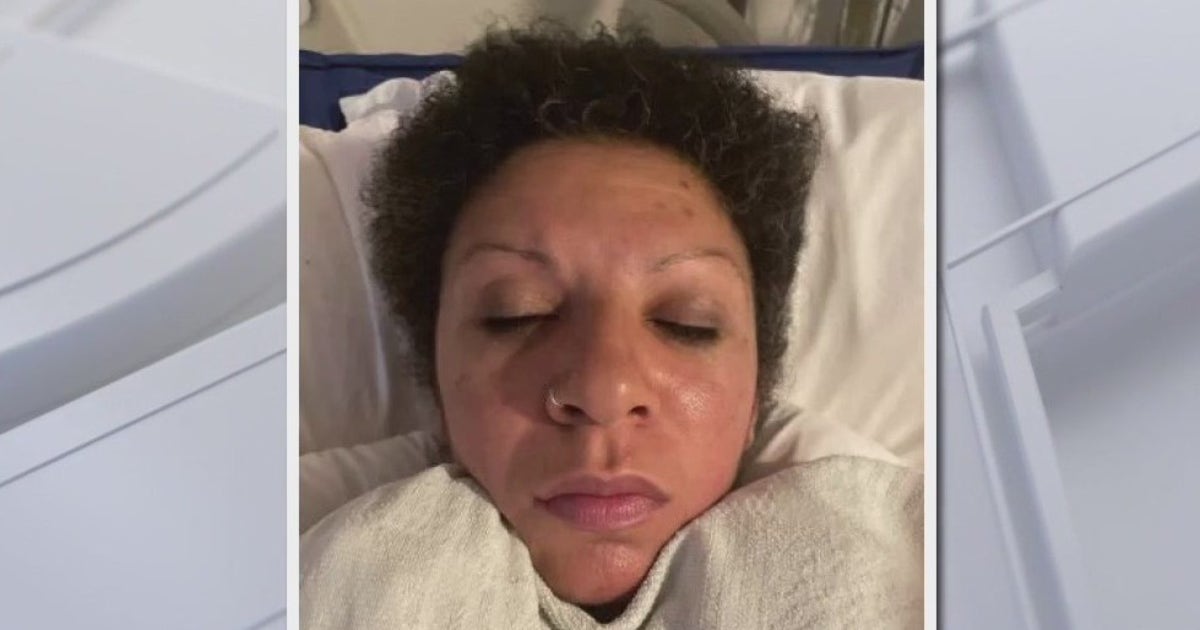 UCSF needs help in identifying patient with tattoos, neck scar | KTVU FOX 2