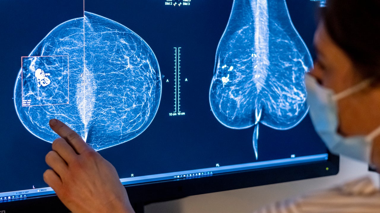 New Fda Rule Requires Info On Breast Density With All Mammograms