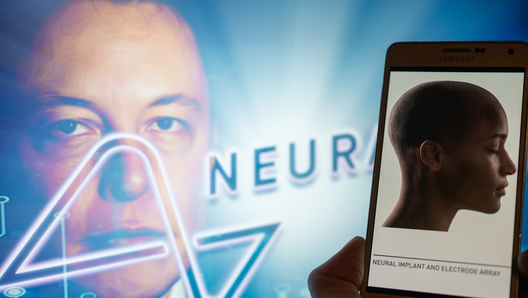 Elon Musks Brain Implant Company Neuralink Says It Has Approval To