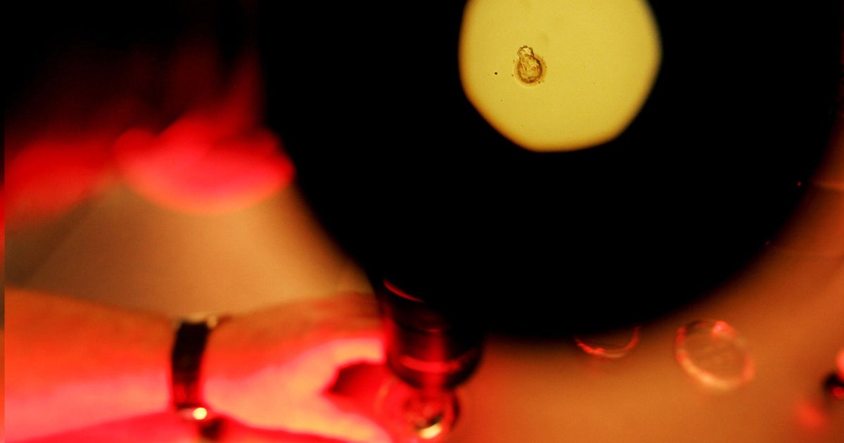 Alabama Supreme Court ruling: Frozen embryos, IVF future explained ...