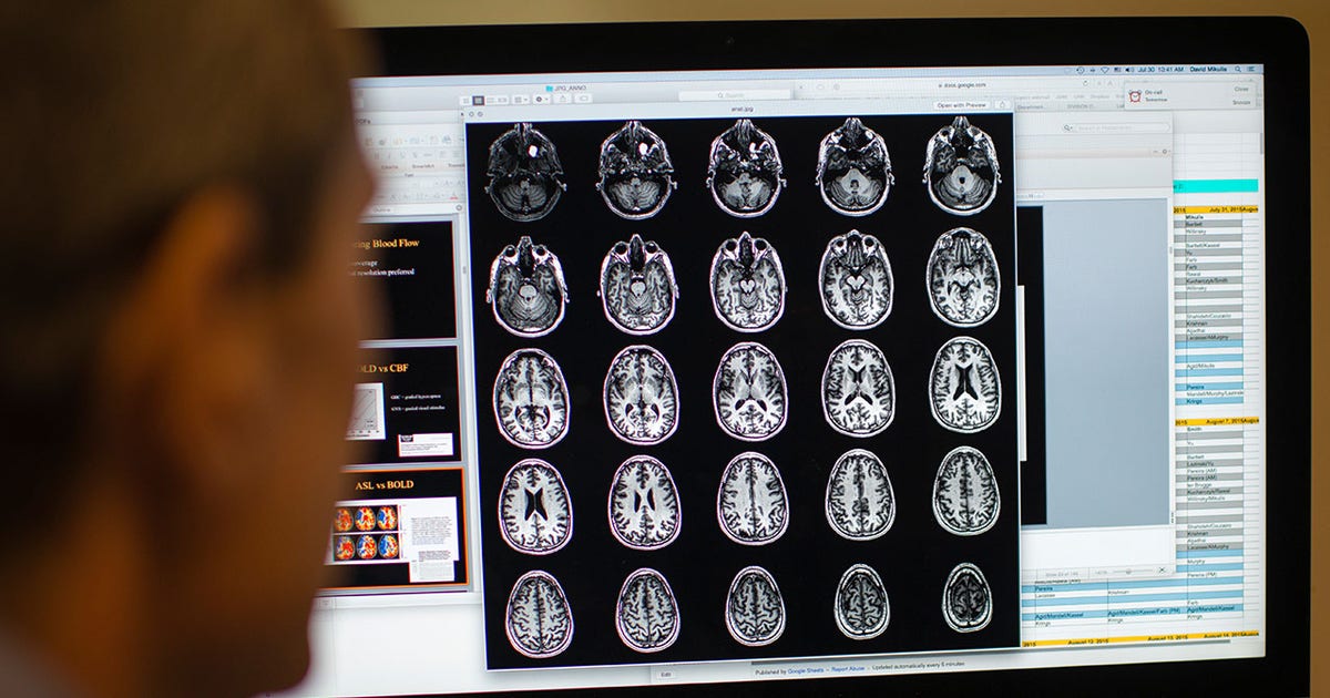 Eli Lilly's Alzheimer's drug delayed by FDA: ‘It was unexpected ...