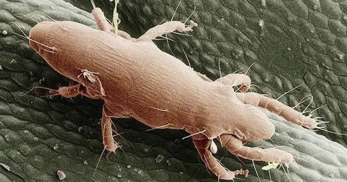 Mysterious bug bites could be from mites feeding on cicada eggs | FOX ...