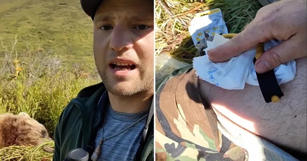 Alaska hunter mauled by bear calmly takes to camera after shooting ...