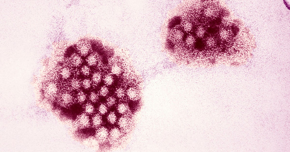 Norovirus outbreak: How to protect yourself from the ‘winter vomiting ...