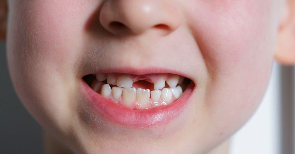 The tooth fairy is getting stingier, annual survey reveals | LiveNOW ...