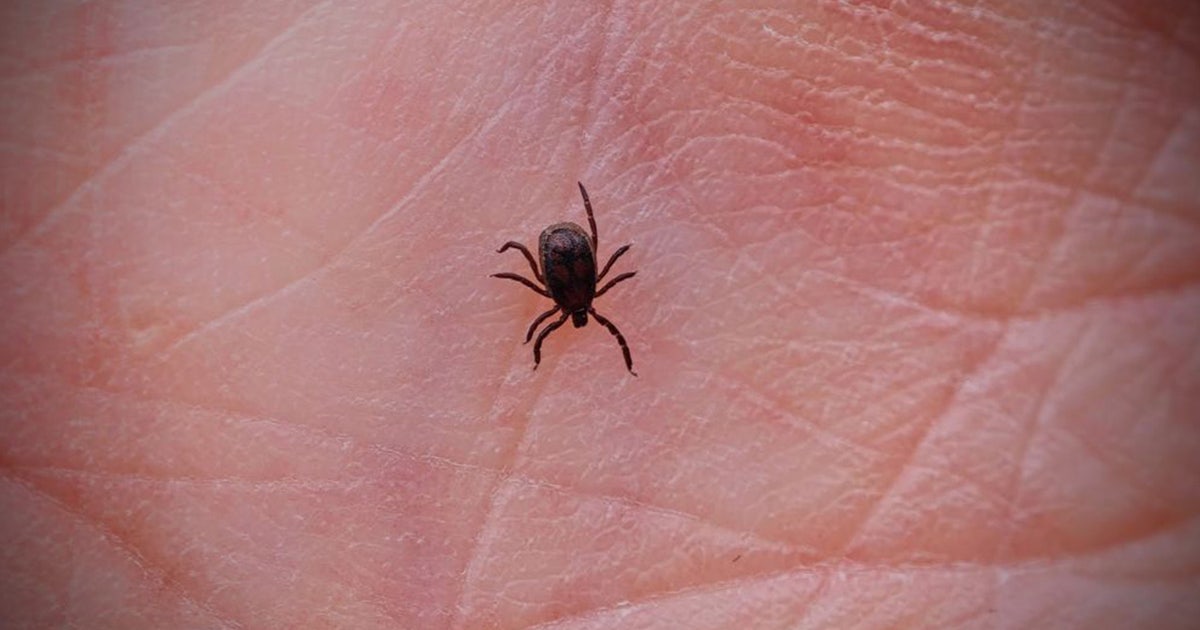 Ticks spread to new regions across America, bringing dangerous diseases ...
