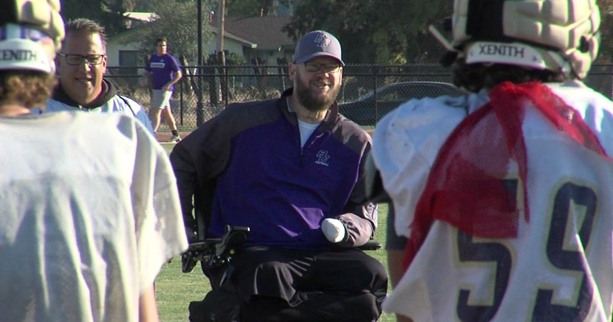 Coach lost both legs, his left hand and some fingers - but not his ...
