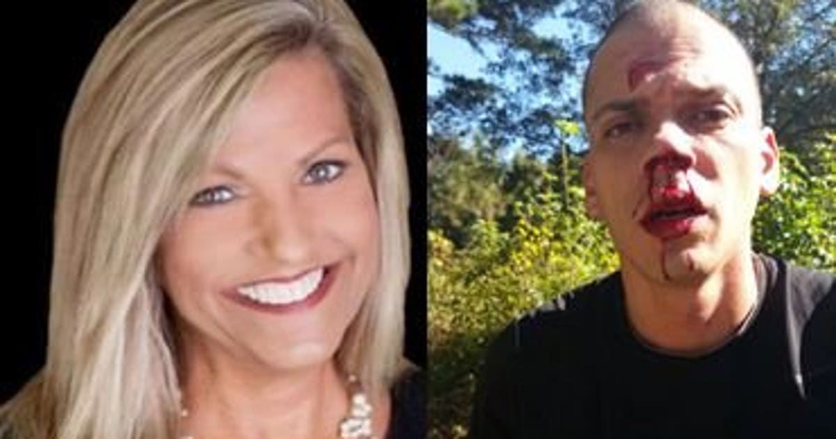 Man in bloody photo wanted in connection with mysterious Realtor ...