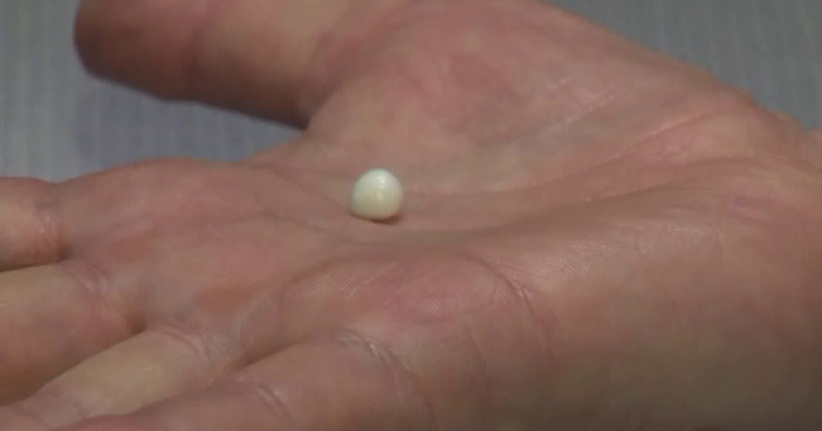 Man finds valuable pearl while eating oysters at New York City ...