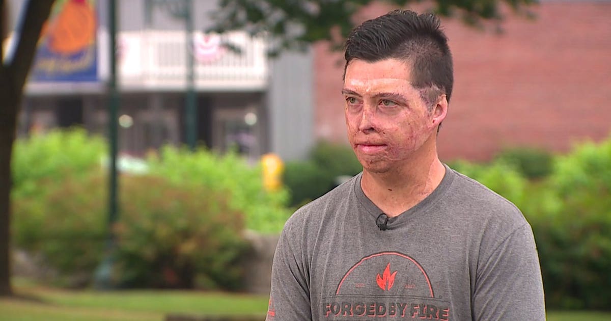 Firefighter severely burned in Twisp fire reaches $5 million settlement ...