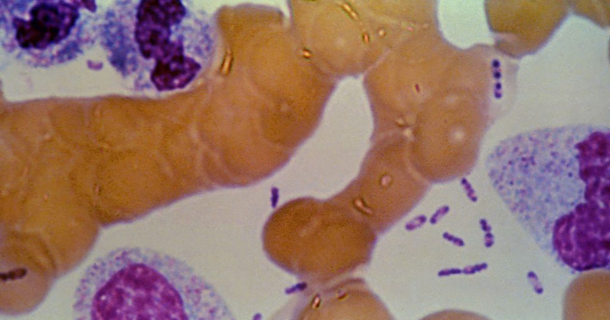 Bubonic plague: What to know after Oregon cat gives owner rodent-borne ...