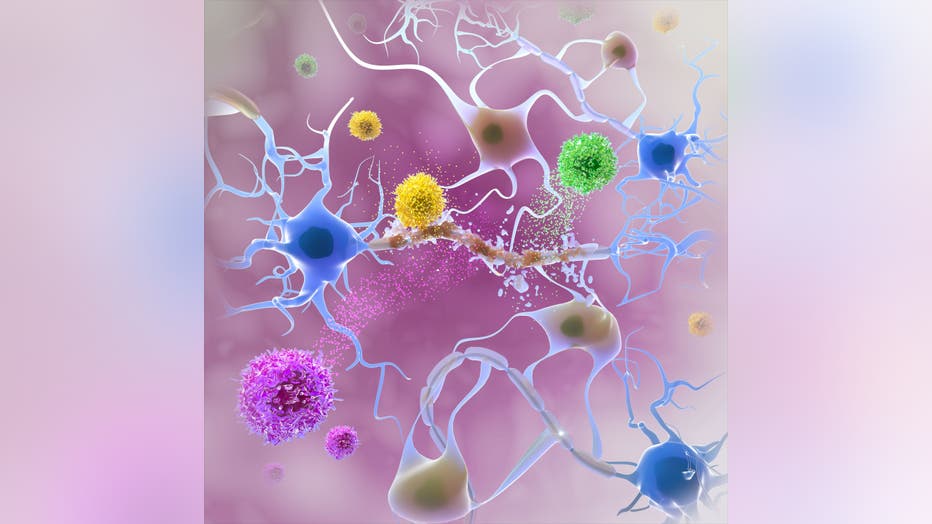 Four out of five autoimmune disease patients are women. New study ...