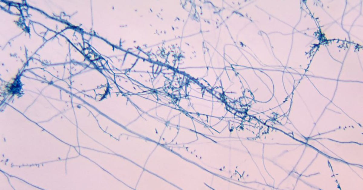 1st case of sexually-transmitted form of ringworm reported in US | FOX ...